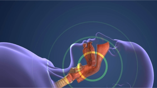 Sleep Apnea and Weight Loss – Understanding the Connection - Transition ...